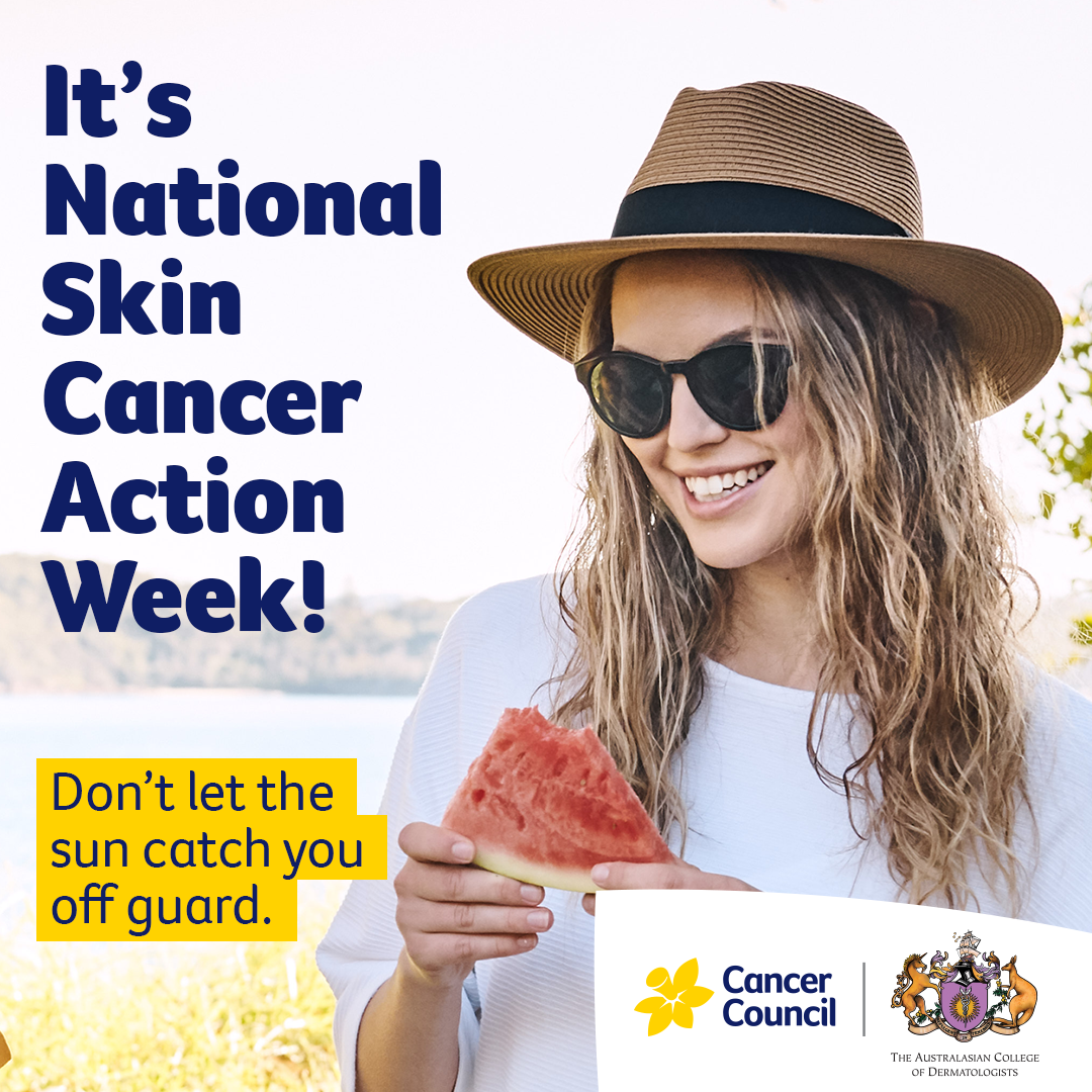 National Skin Cancer Action Week | Combatting Australia’s ‘national ...