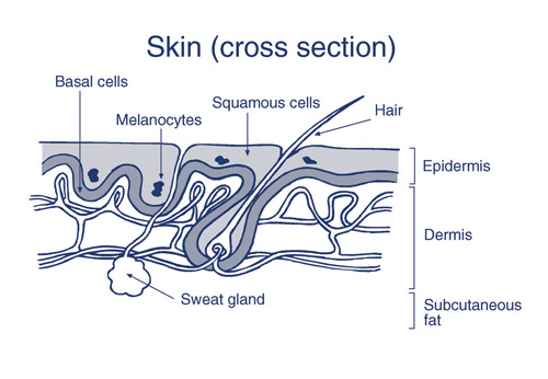Skin cancer types | National Cancer Prevention Policy Skin Cancer ...