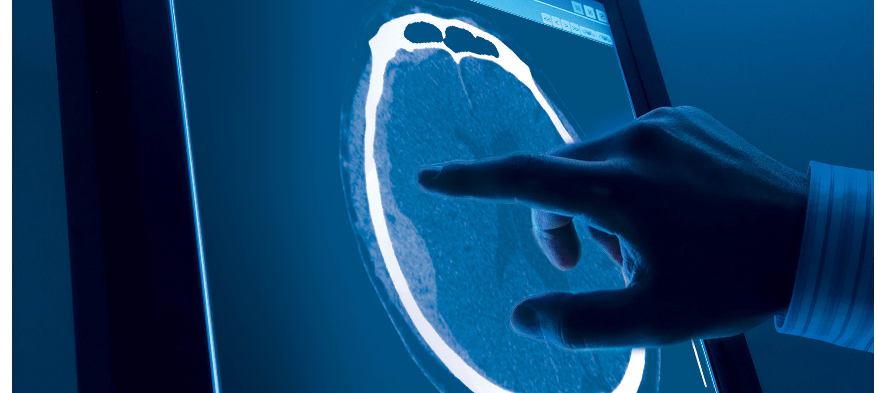 I-TeleRAD | Your partner in round-the-clock radiology reporting.