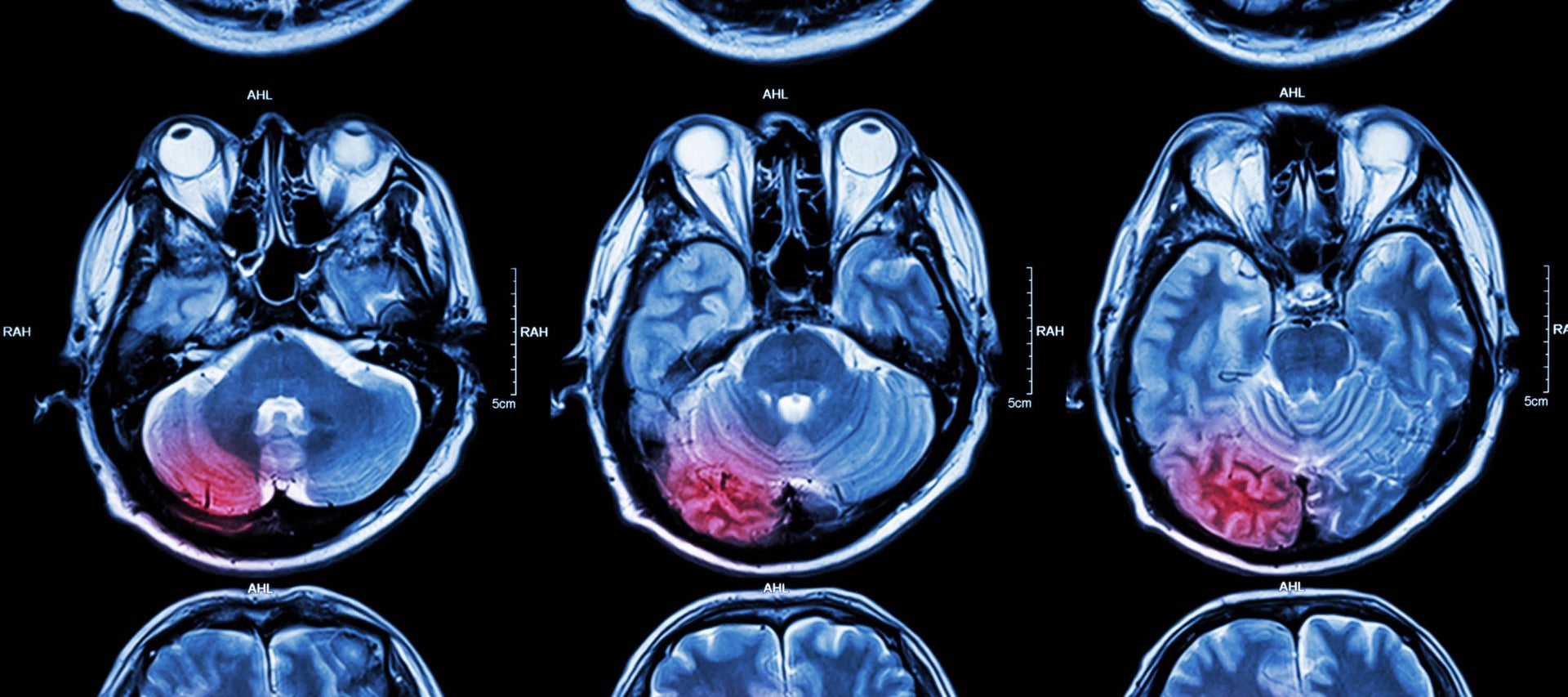 I-TeleRAD | Your partner in round-the-clock radiology reporting.